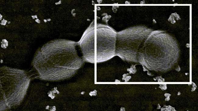 Vaginal “Bacterial Weapons” Are Causing Stillbirths